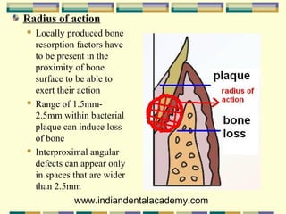 Bone loss & patterns of bone loss /certified fixed orthodontic courses ...