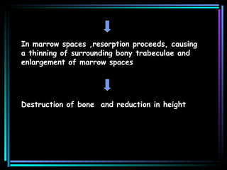 Bone loss | PPT