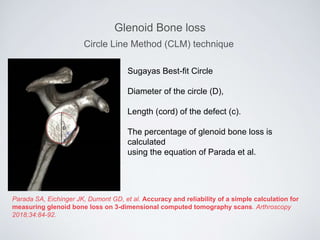 Recurrent Anterior instability of Shoulder with bone loss | PPTX
