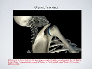 Recurrent Anterior instability of Shoulder with bone loss | PPTX