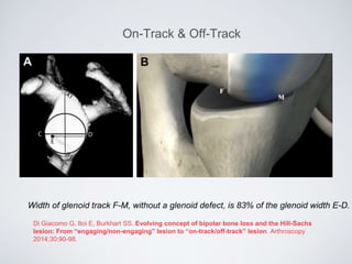 Recurrent Anterior instability of Shoulder with bone loss | PPTX