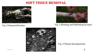 Bone maceration | PPTX