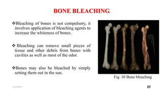 Bone maceration | PPT