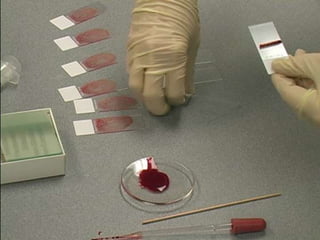 Bone marrow aspirate&biopsy preparation | PPTX
