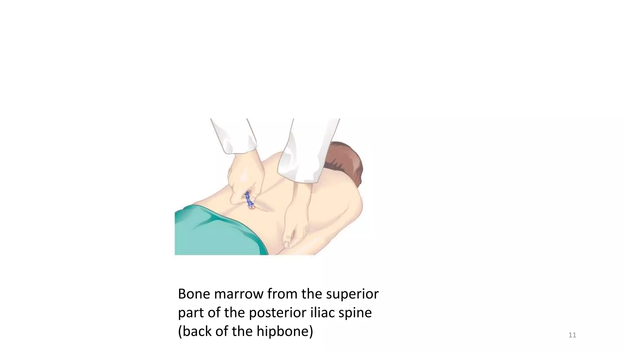 bone marrow aspiration.pptx