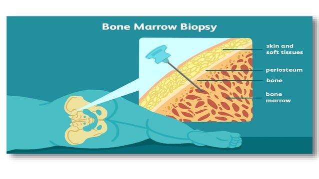bone marrow aspiration.pptx