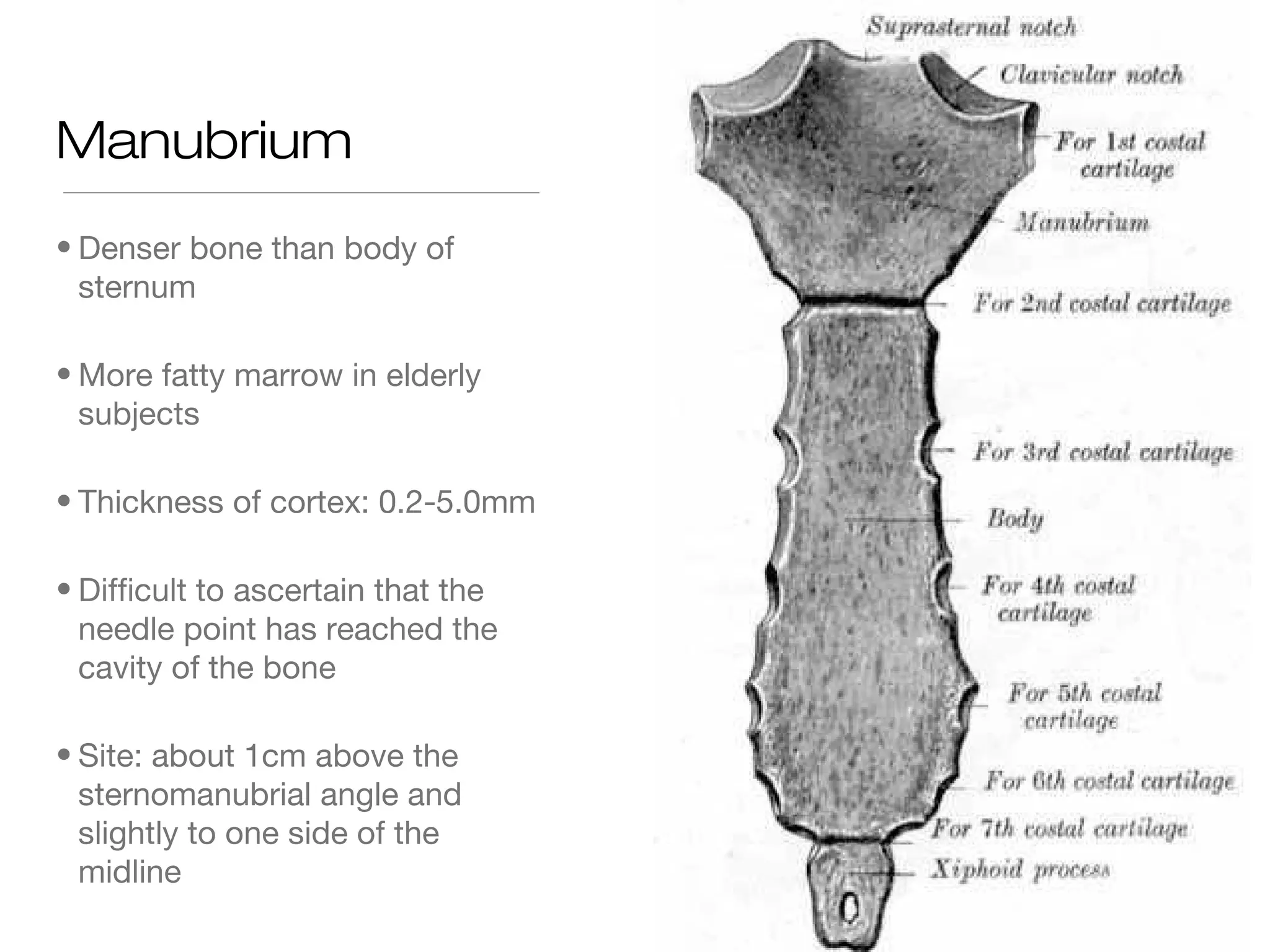 Bone marrow aspiration and biopsy | PPT