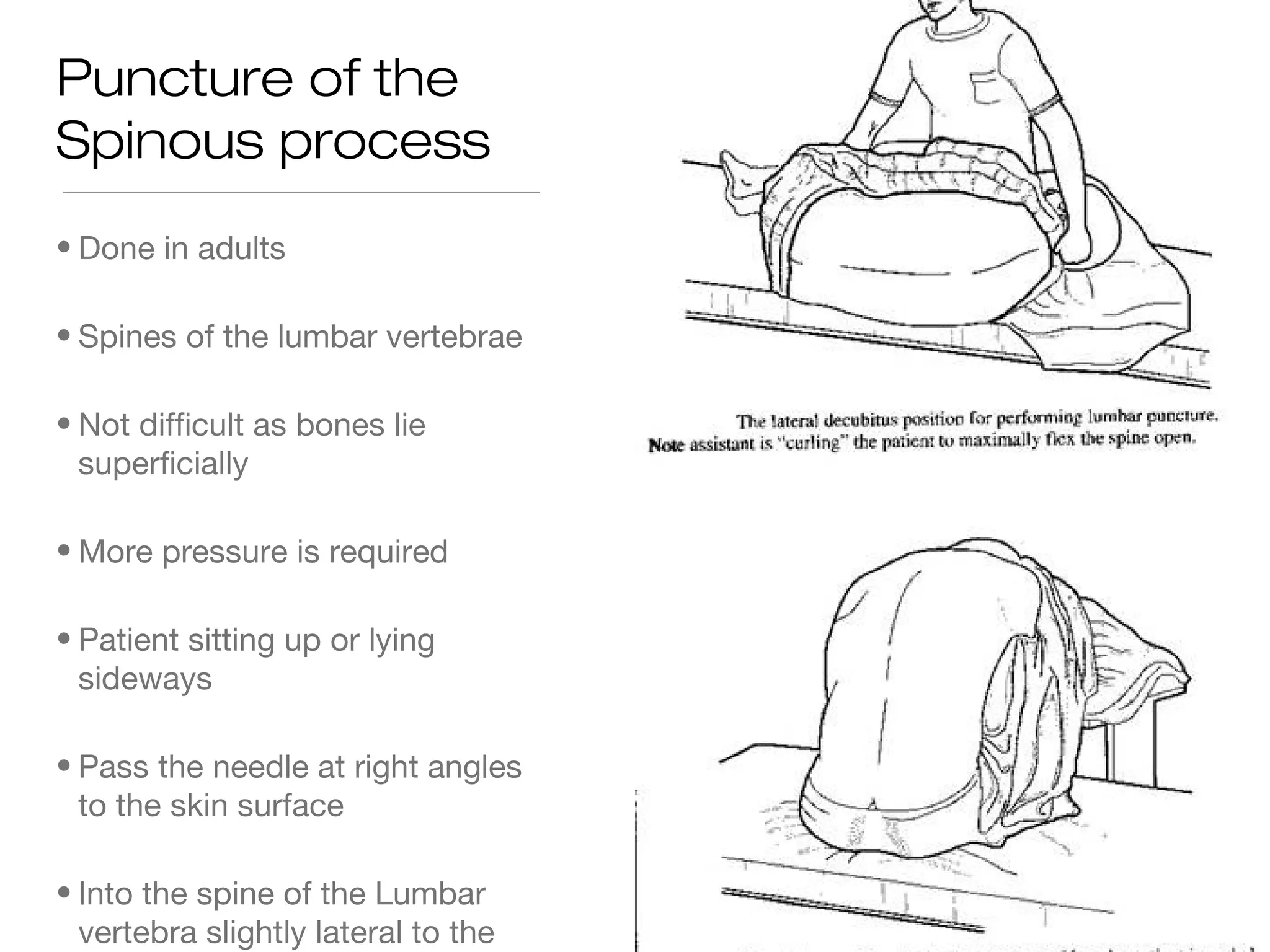 Bone marrow aspiration and biopsy | PPT