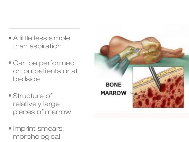 Bone marrow aspiration and biopsy