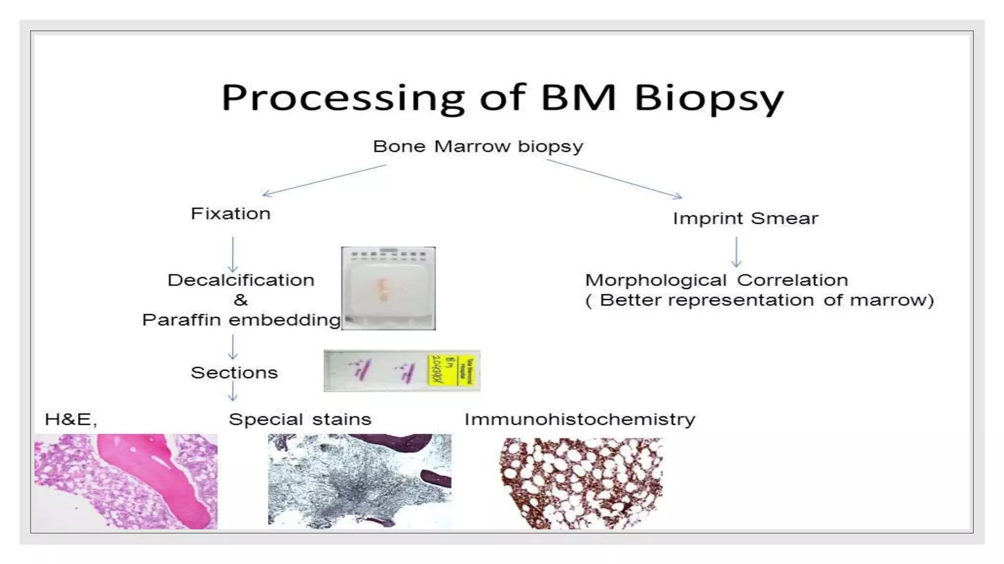 Bone marrow aspiration & biopsy | PPTX