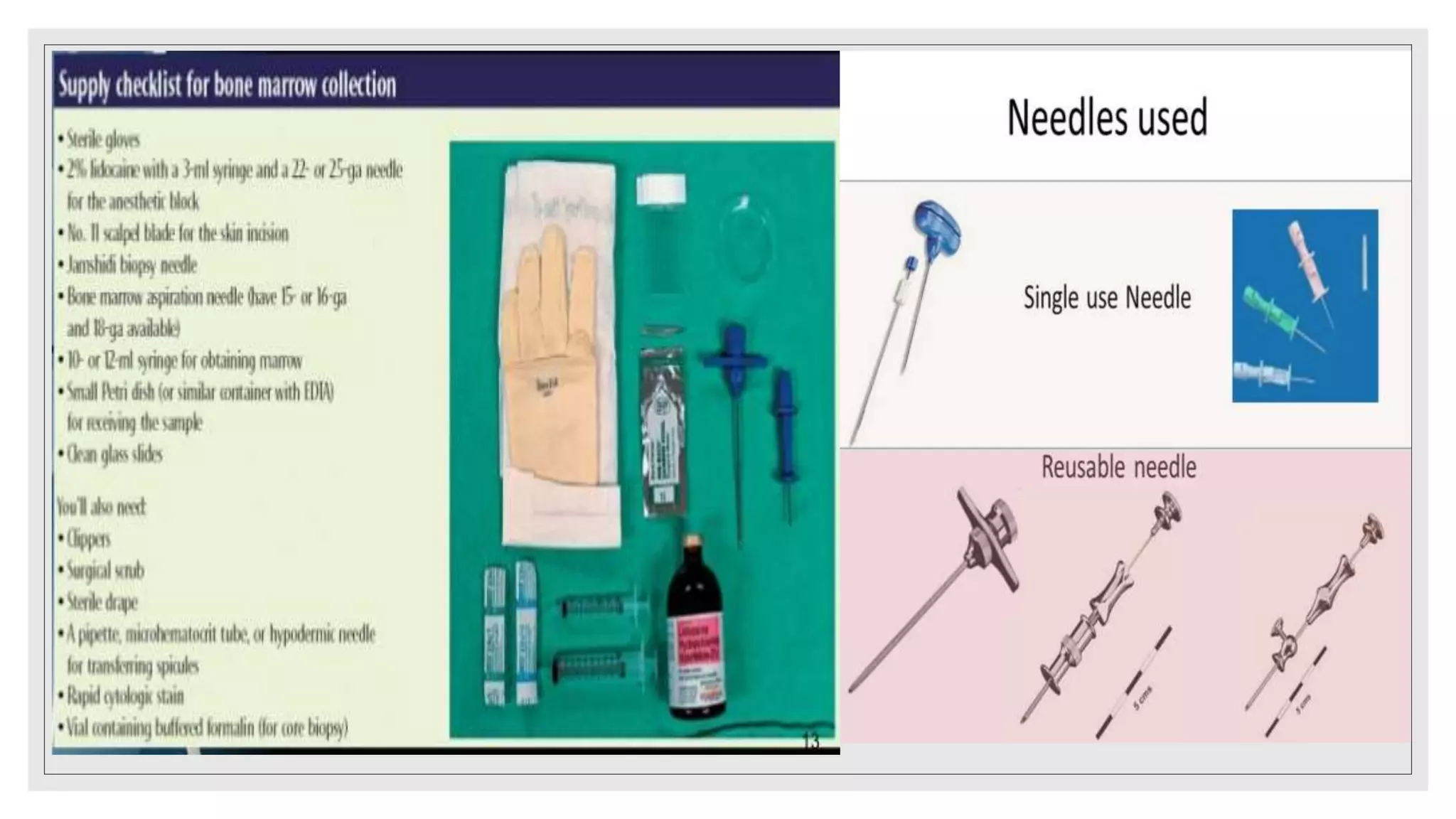 Bone marrow aspiration & biopsy | PPTX