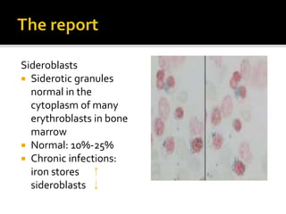 Bone marrow aspiration reports | PPTX