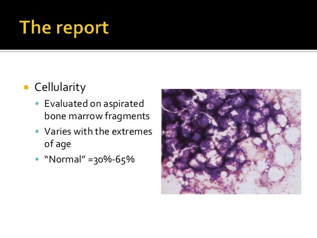 Bone marrow aspiration reports