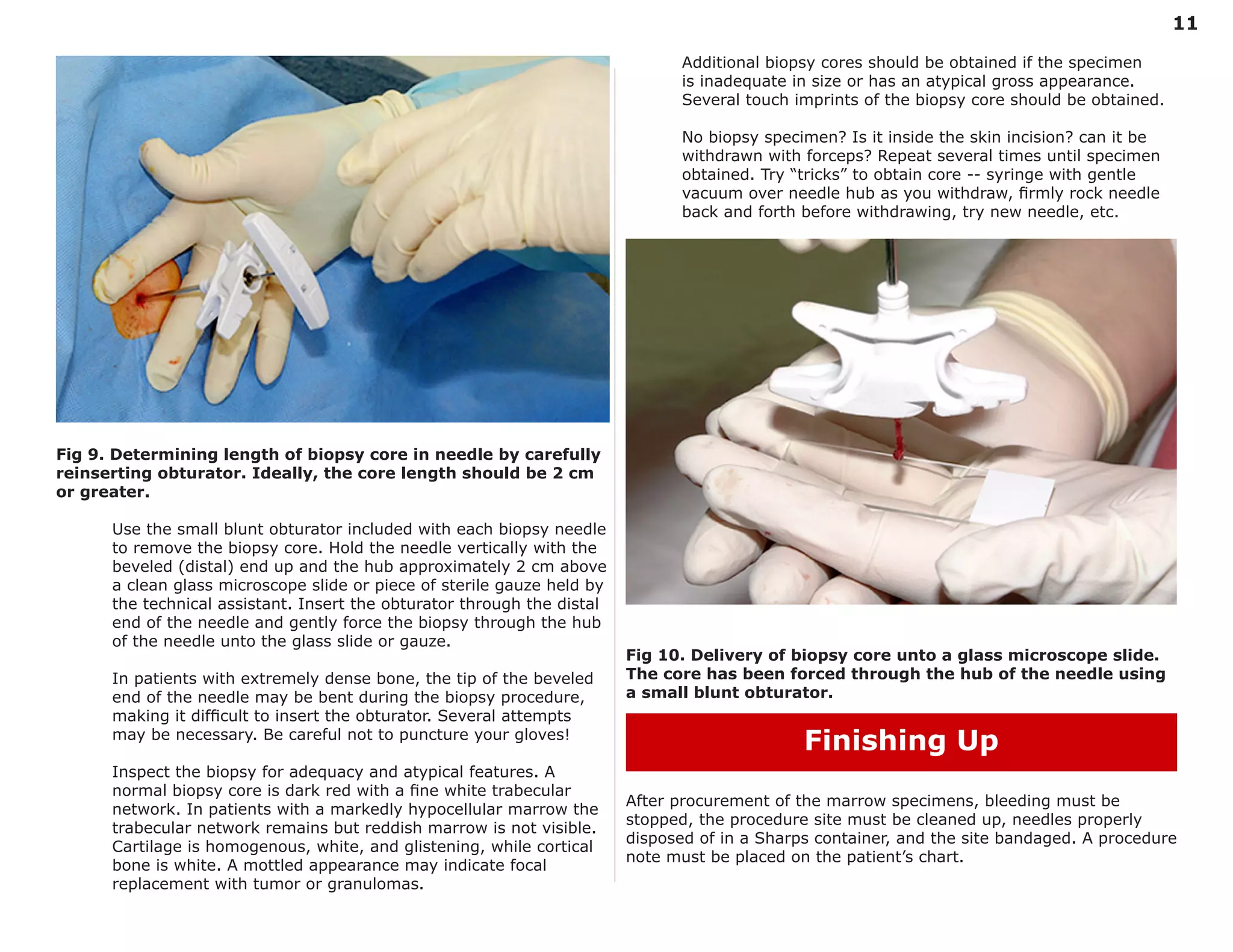 Bone marrow aspiration technique.pdf