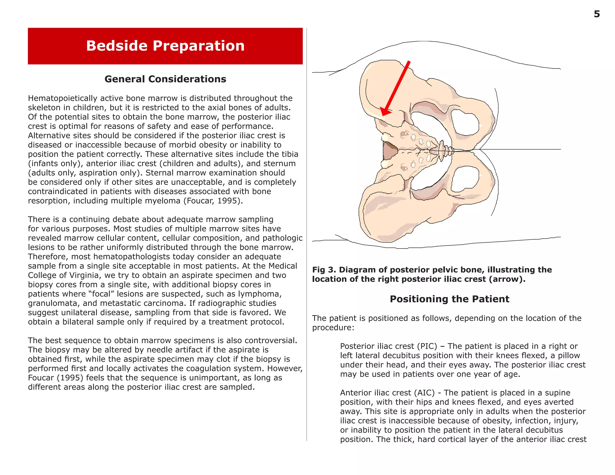 Bone marrow aspiration technique.pdf