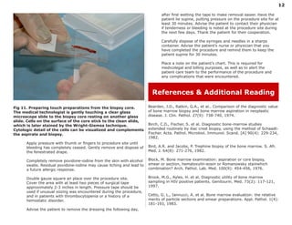 Bone marrow aspiration technique.pdf