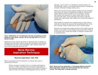 Bone marrow aspiration technique.pdf