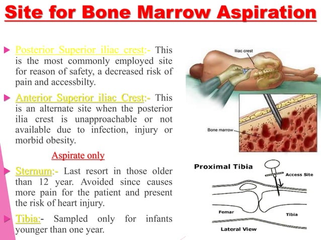 Bone marrow aspiration & trephine biopsy | PPTX