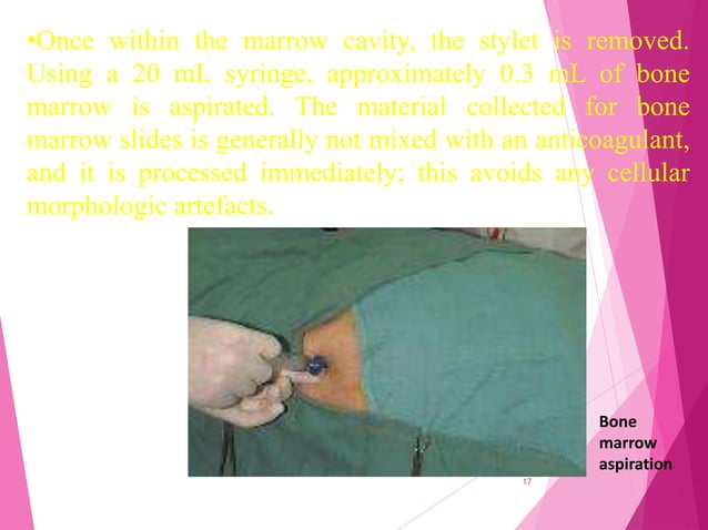 Bone marrow aspiration & trephine biopsy | PPTX