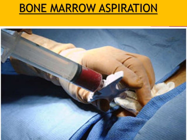 Bone marrow aspiration & trephine biopsy | PPTX