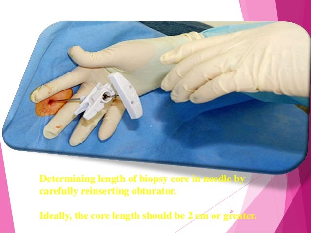 Bone marrow aspiration & trephine biopsy