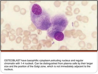 Bone marrow biopsy | PPTX
