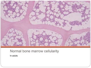 Normal Bone Marrow Biopsy