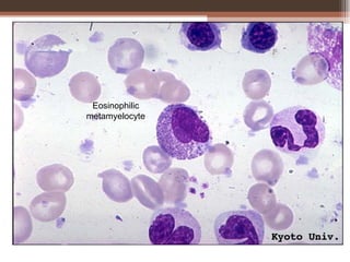 Metamyelocyte Lineage