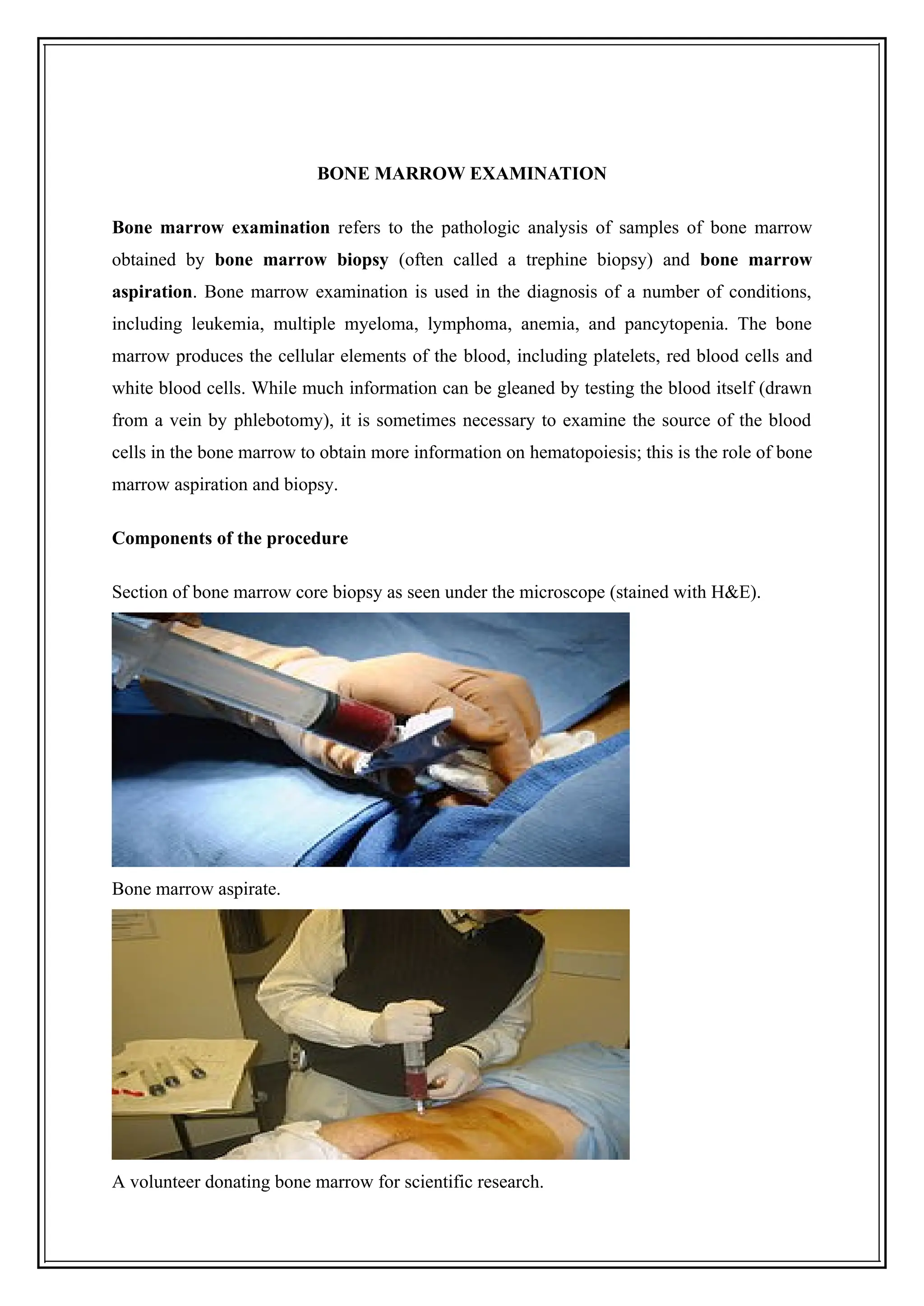 Bone marrow examination, procedures,complications | DOCX