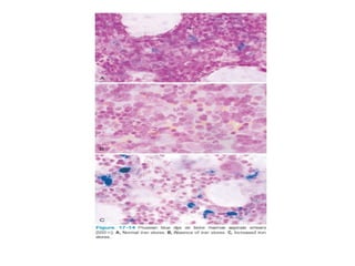 BONE MARROW EXAMINATION presentation for pathology | PPTX