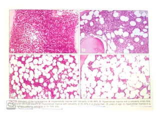 BONE MARROW EXAMINATION presentation for pathology | PPTX