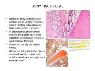 BONE MARROW EXAMINATION presentation for pathology | PPTX