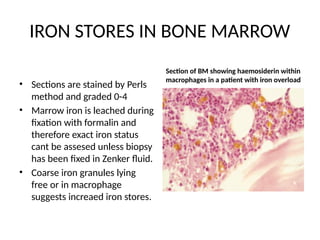 BONE MARROW EXAMINATION presentation for pathology | PPTX