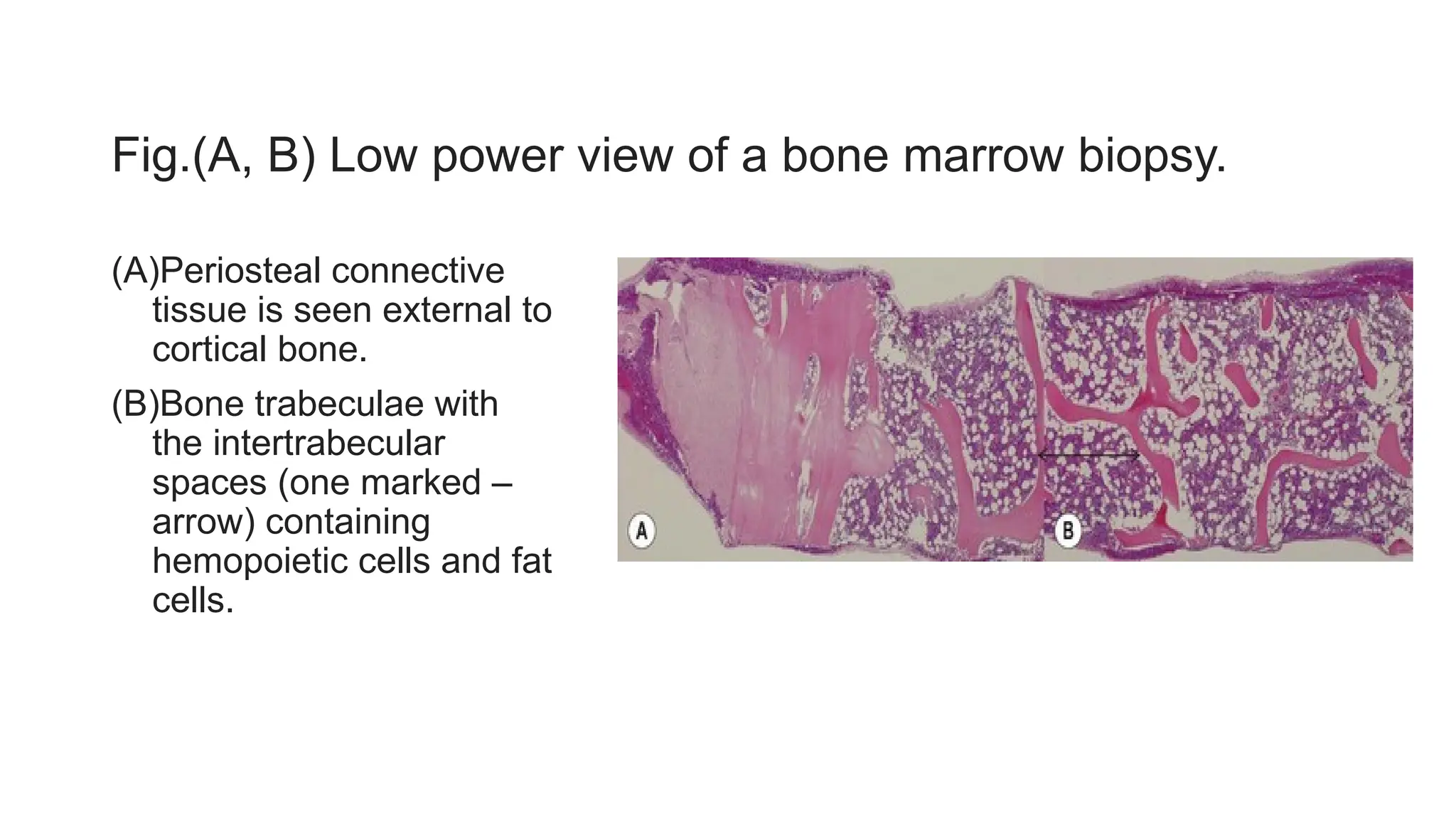 BONE MARROW & HEMATOPOIESIS..................pptx