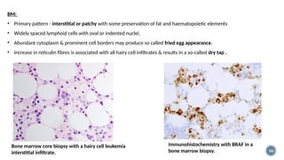 BONE MARROW IN LEUKEMIAS.types of leukaemia | PPTX