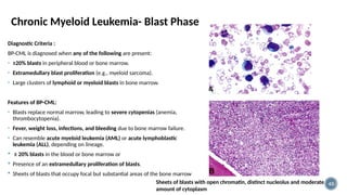 BONE MARROW IN LEUKEMIAS.pptx types of leukemia | PPTX
