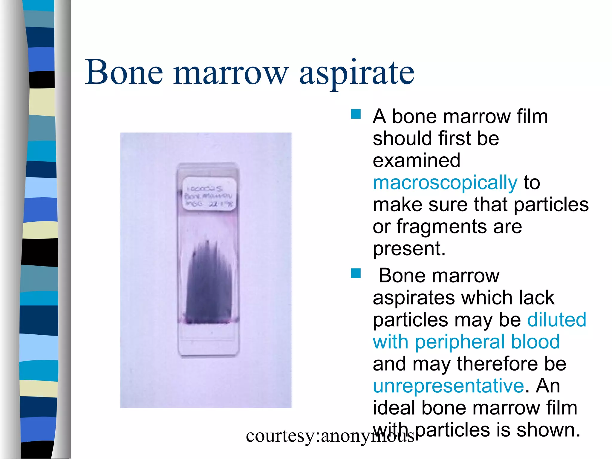 Bone marrow morphology | PPT