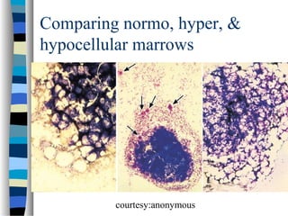 Bone marrow morphology | PPT
