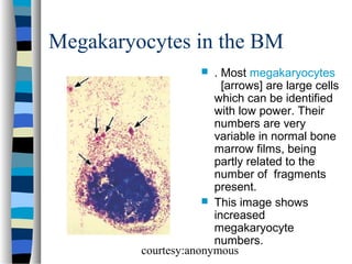 Megakaryocyte In Bone Marrow