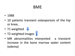 BONE MARROW LESIONS IN KNEE JOINT I DR.RAJAT JANGIR ORTHOPAEDIC DOCTOR ...