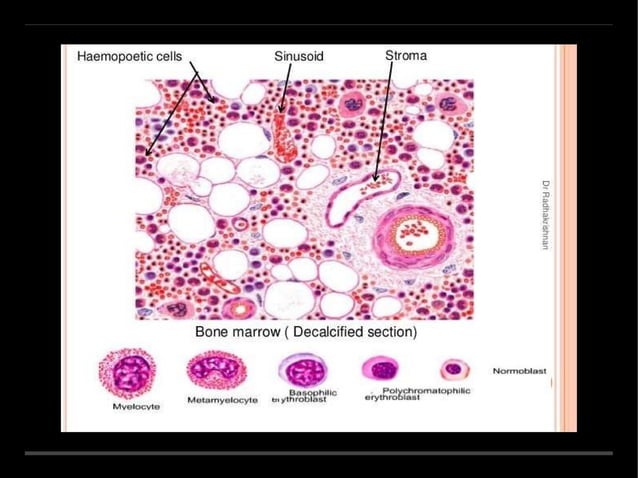 bone marrow ppt about bone marrow biopsy | PPT