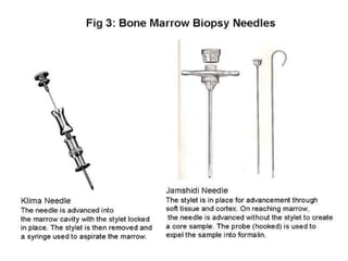 Bone marrow procedure’!!!2 | PPT