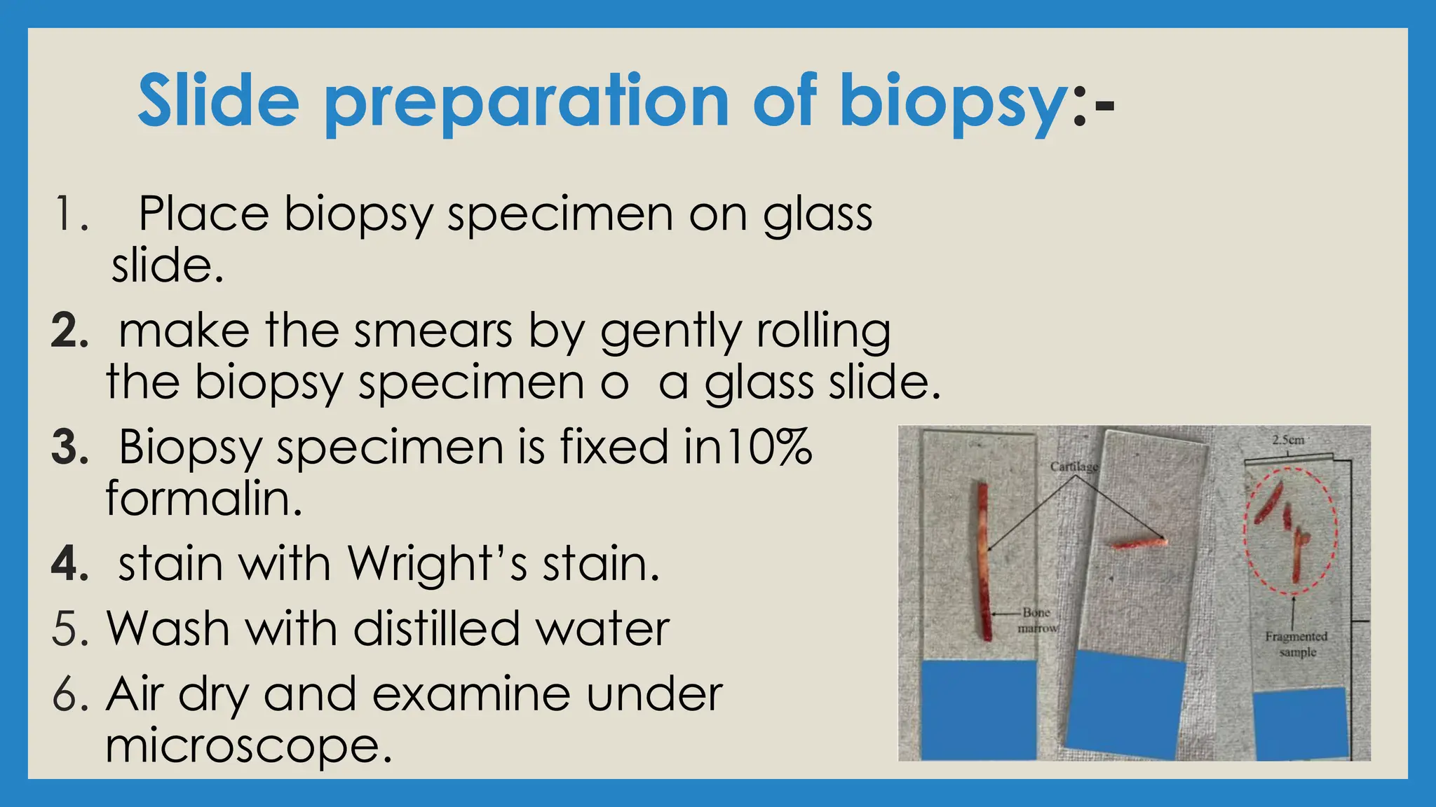 bone marrow smear preparation and statining.pdf