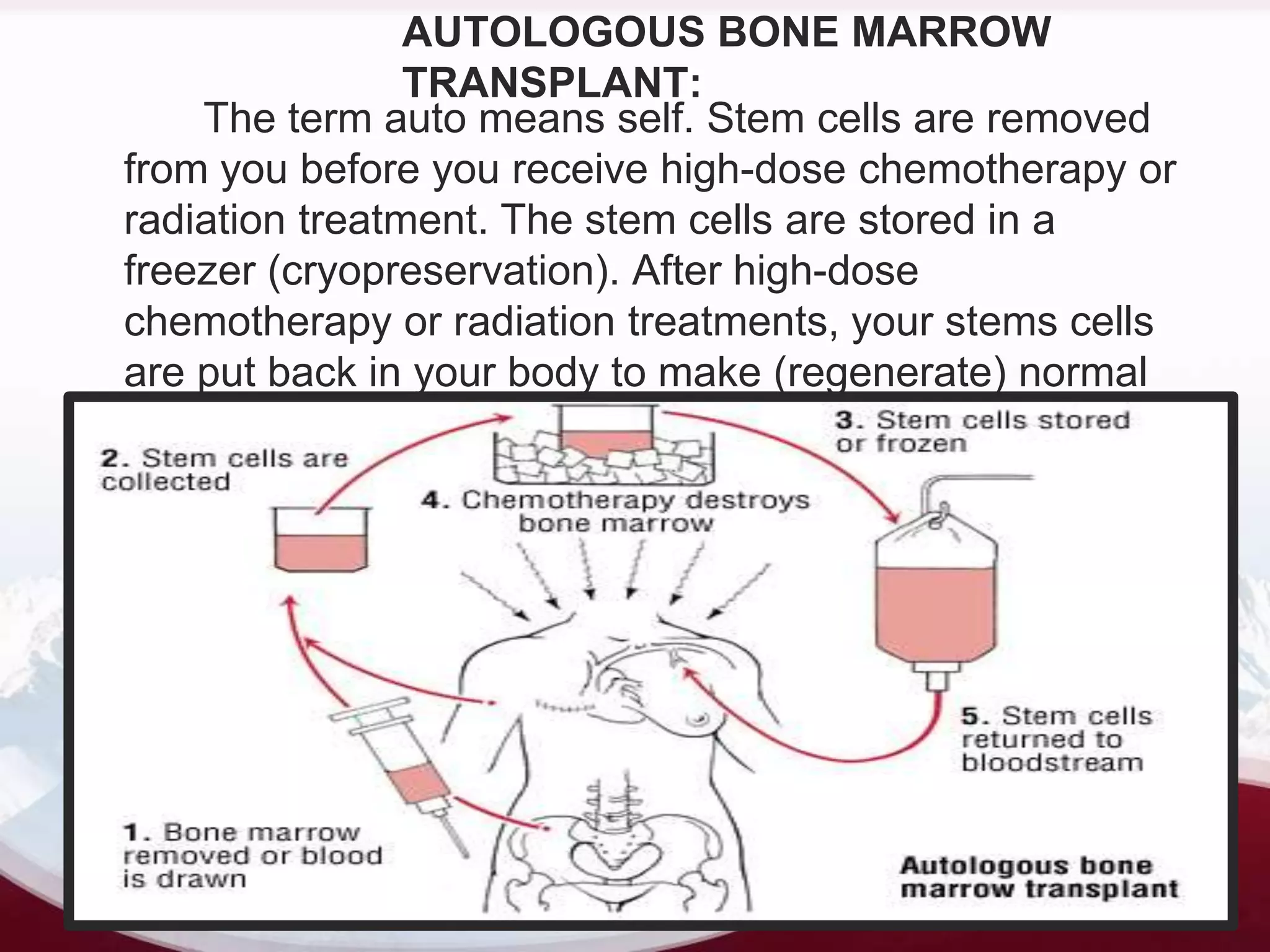 Bone marrow transplantation | PPTX