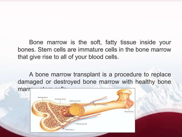 Bone marrow transplantation | PPTX