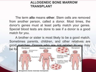 Bone marrow transplantation | PPTX