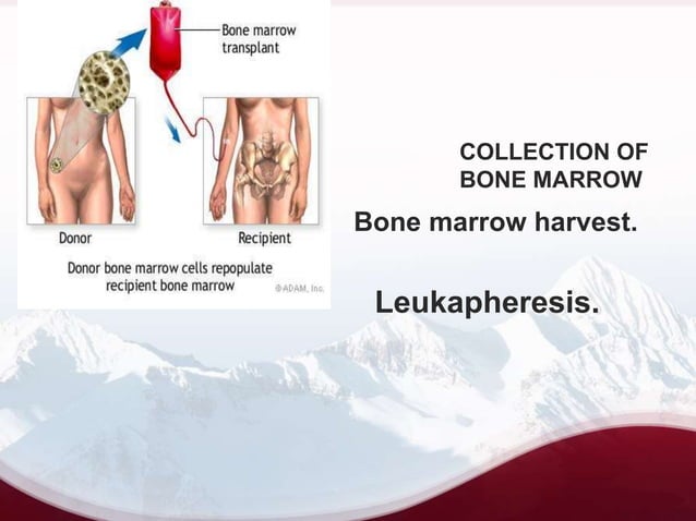 Bone marrow transplantation | PPTX