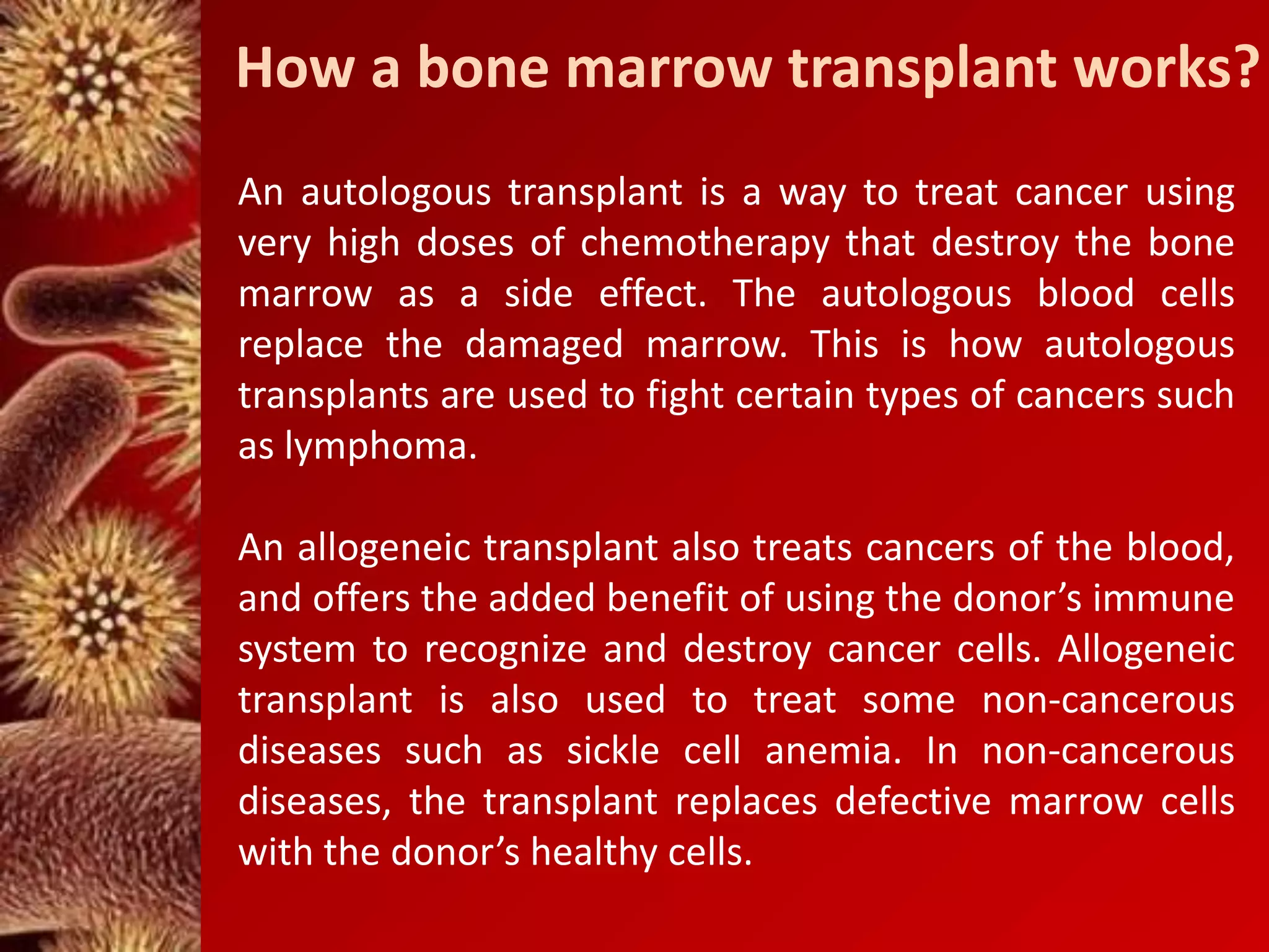 Bone marrow transplant | PPTX