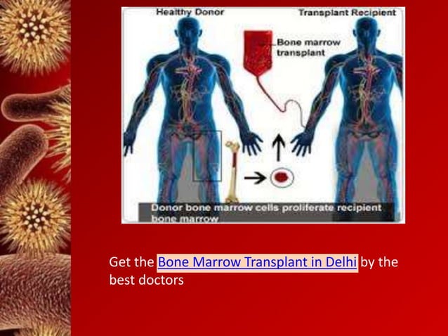 Bone marrow transplant | PPT