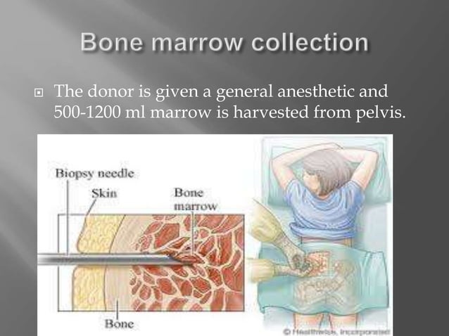 Bone marrow transplantation | PPTX
